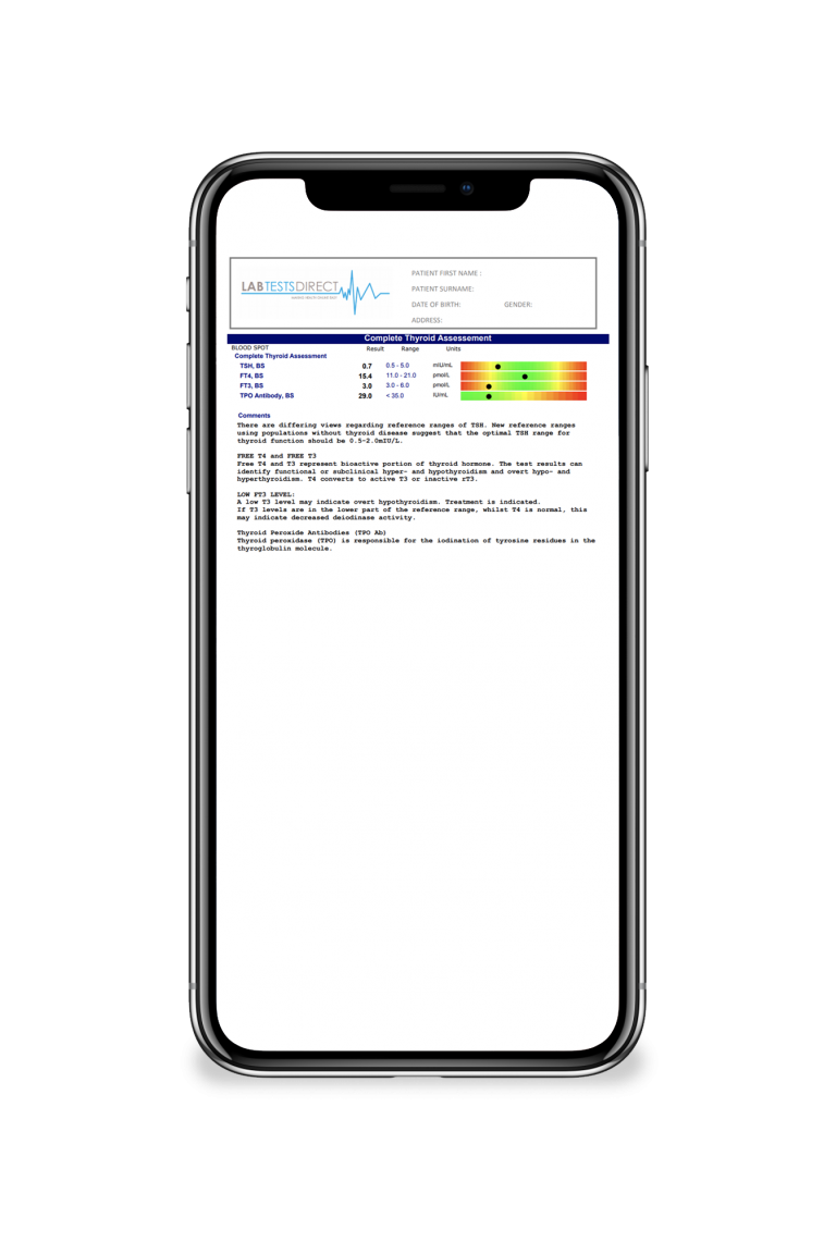 COMPLETE THYROID SCREEN - Lab Tests Direct